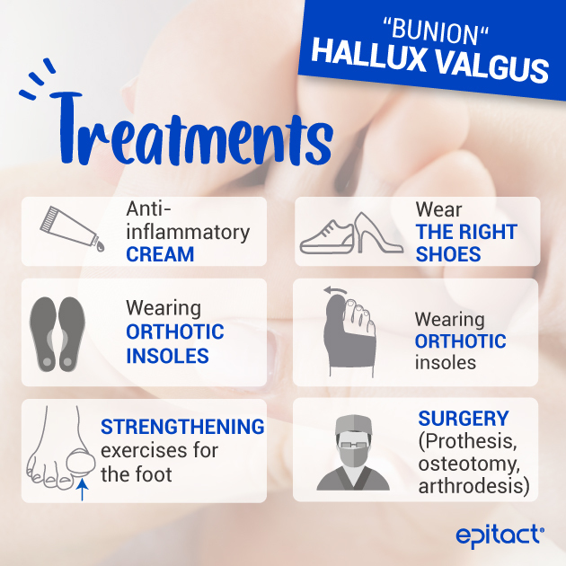 Bunion correction surgery: techniques for bunion removal | Epitact